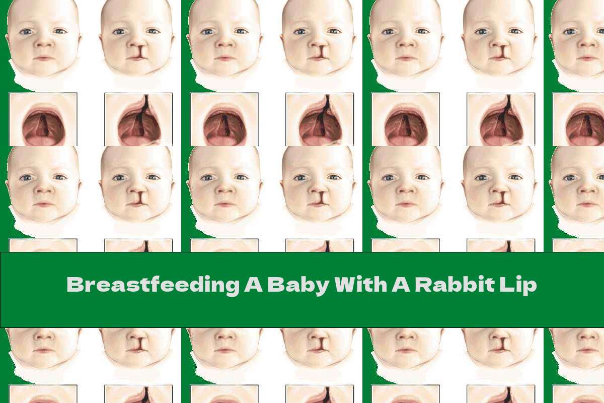 Breastfeeding A Baby With A Rabbit Lip - This Nutrition