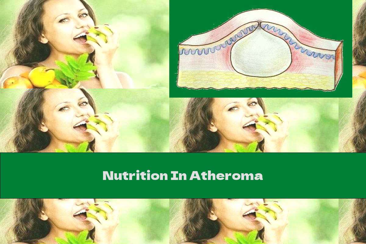 Nutrition In Atheroma - This Nutrition