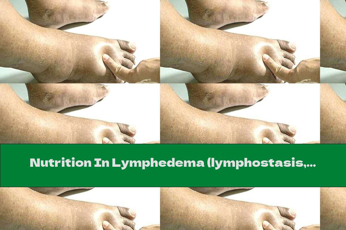 Nutrition In Lymphedema (lymphostasis, Elephantiasis, Elephantiasis ...